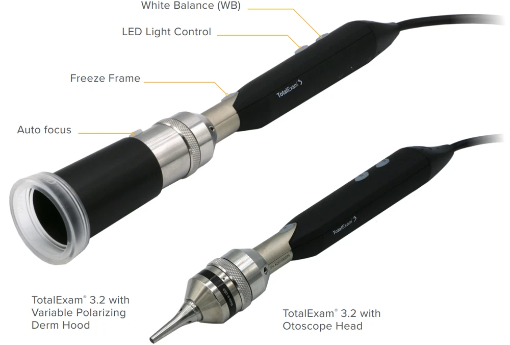 GlobalMed Telemedicine TotalExam 3.2 Exam HD Camera Otoscope Dermoscope ...