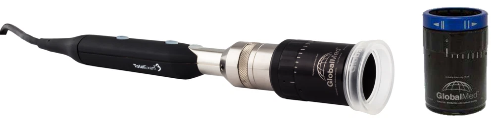 GlobalMed Telemedicine TotalExam 3.2 Exam HD Camera Otoscope Dermoscope ...